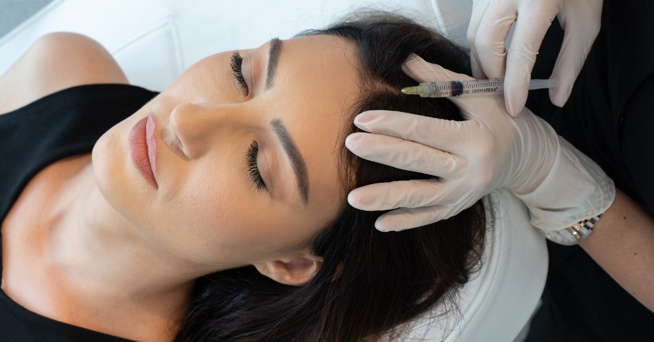 PRP Scalp: terapia „vampir” pentru revitalizarea capilară